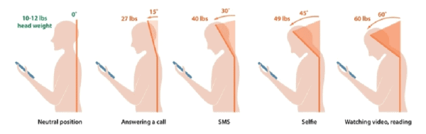 Patients Ask: What is Text Neck Syndrome?